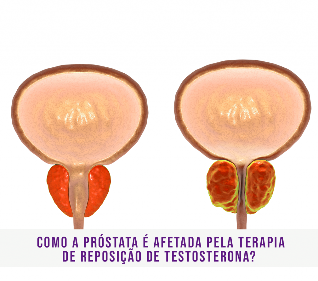 Terapia De Reposição De Testosterona O Que é Isso Cenegenics® Portugal